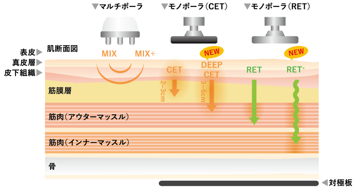 高周波とは？美容や健康への効果やメリットを解説！ | WINBACK（ウィンバック）ポータル